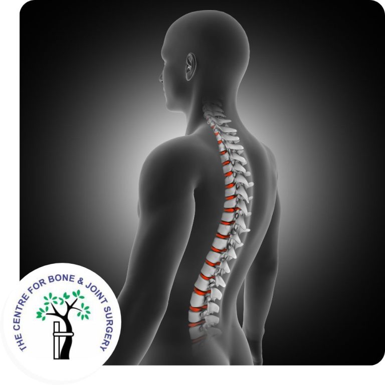 Spine & Back Care – Dr Subodh Mehta